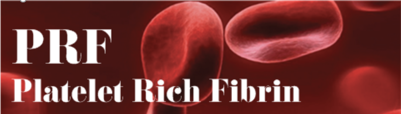 Torrance CA Platelet Rich Fibrin (PRF) for Oral Surgery | Palos Verdes