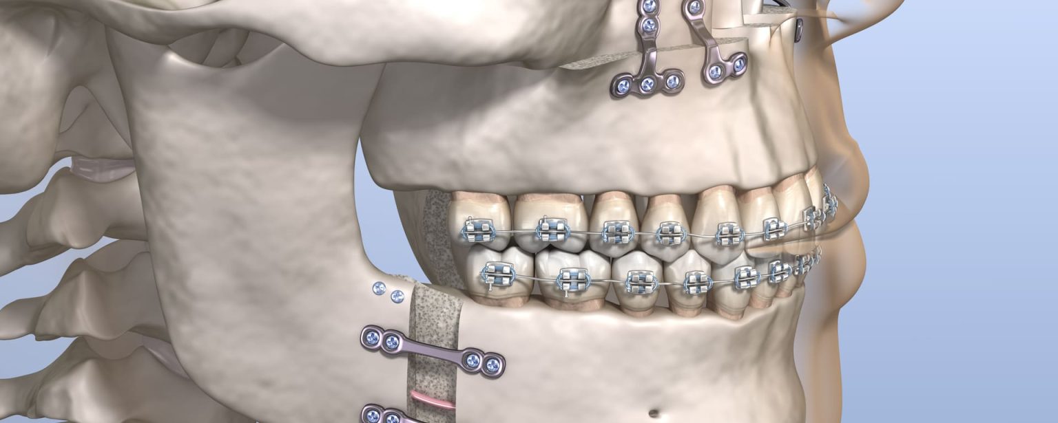Torrance Facial Trauma Oral Surgery | Palos Verdes Jaw Reconstruction