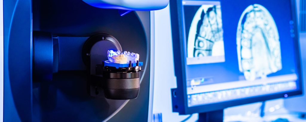 Torrance CA Digital Dentistry | 3D Intra Oral Scanning, Printing